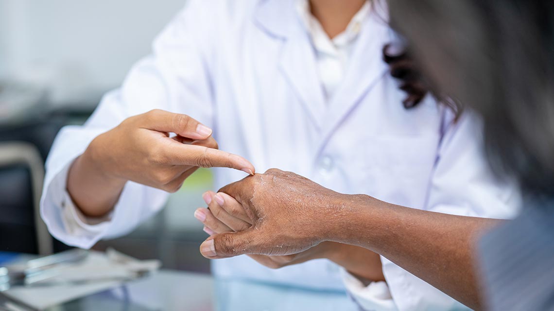 Support Our Work | International Psoriasis Council